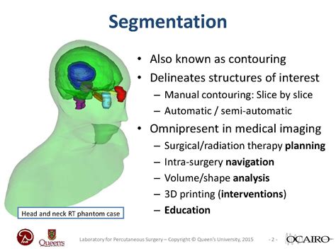 File20160526 Segmentationspdf Slicer Wiki