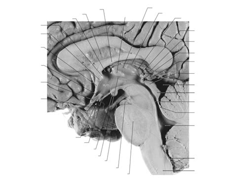 Brain Morphology Part 3 Quiz