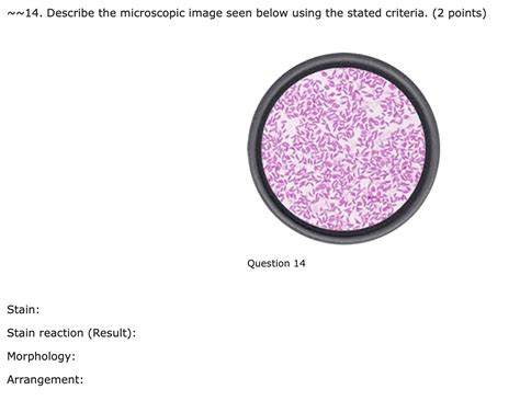 Solved ∼∼12 Describe The Microscopic Image Seen Below Using