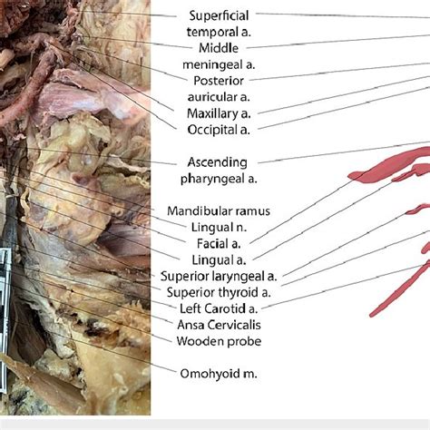 Dissection Of The Left Neck Dissection Of The Left Neck Revealing The Download Scientific