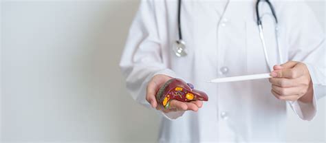 인간 간 해부학 모델을 들고 있는 의사 간암 및 종양 황달 바이러스성 A B C D E 간경변 부전 비대 간성 뇌병증 복수액 및 건강 간 내부 기관에 대한 스톡 사진 및