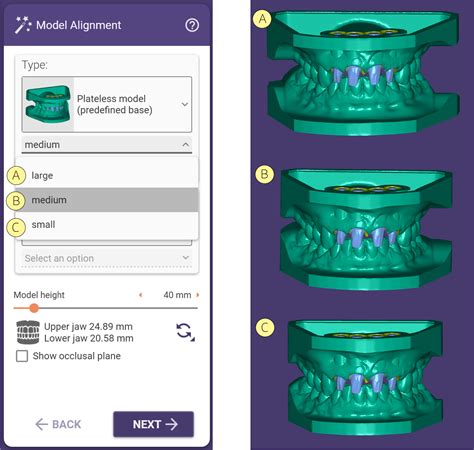 File Model Alignment FR 5 Png Exocad