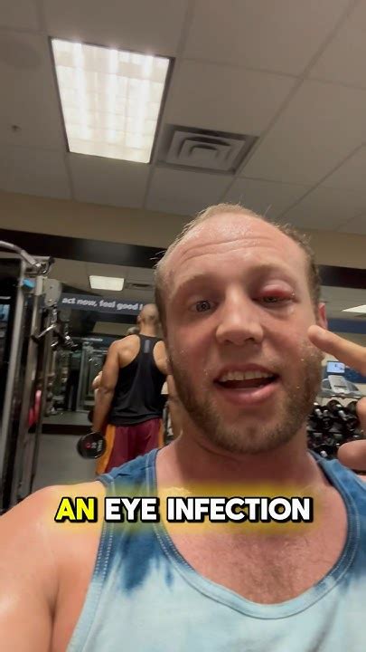 Sould You Still Go To The Gym With An Eye Infection Yes Workout
