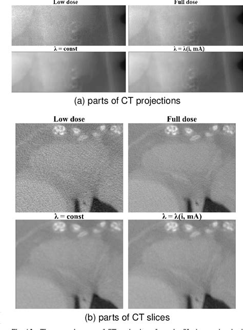 self supervised physics based denoising for computed tomography