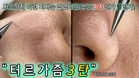 피지 직접 뽑아드렸습니다 피지제거 블랙헤드제거 피지뽑기 대한민국을 터르가즘으로 통일 해보겠다 노원 피지1짱 그녀 3탄 Youtube