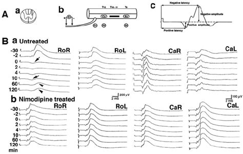 A SCEP Recording And Methods Spinal Cord Injury Model A Recording Download Scientific