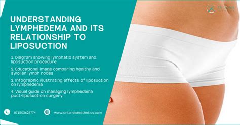 What Is Lipo Lymphedema Causes And Treatment 2025