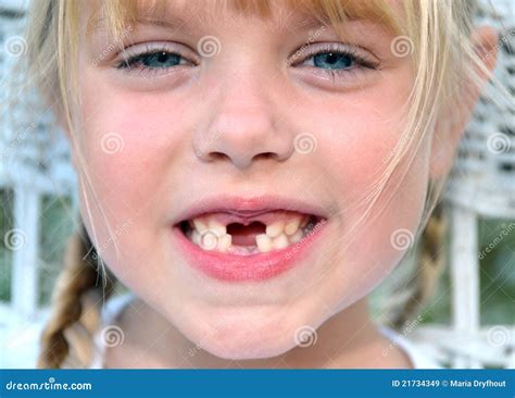 Girl Missing Teeth Stock Image Image Of Girl Toothy 21734349