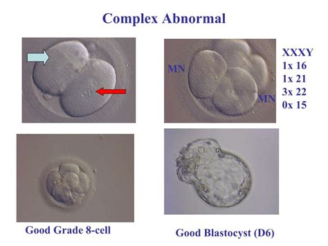 Ppt Oocyte And Embryo Selection Using Sequential Embryo Selection