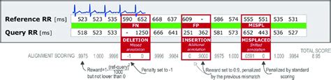 Illustration Of A Smith Waterman Like Algorithm For Rr Interval Download Scientific Diagram