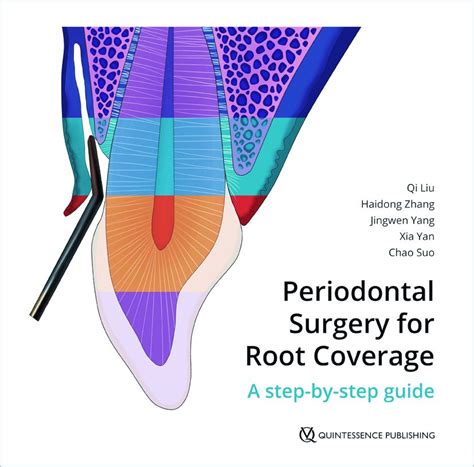 Periodontal Surgery For Root Coverage Wydawnictwo Kwintesencja