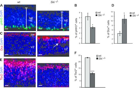 Fig S2 Ski Ablation Reduces Neural Progenitor Cell Numbers And Causes Download Scientific