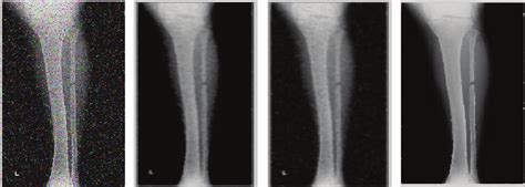 Removing Gaussian Noise And Salt And Pepper Noise Download Scientific Diagram