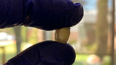 Colgate Oral Health Network