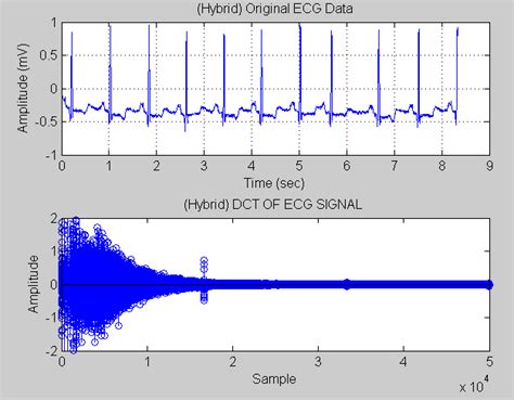 Original Ecg Signal And Dct Of The Signal Of Mit Bih Record 100