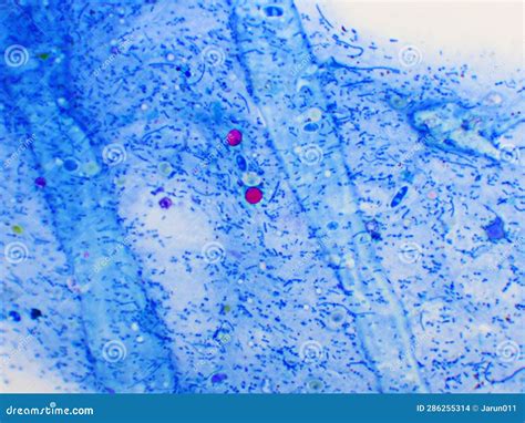 Cryptosporidium Parvum Protozoa Positive In Human Stool Smear Royalty Free Stock Image