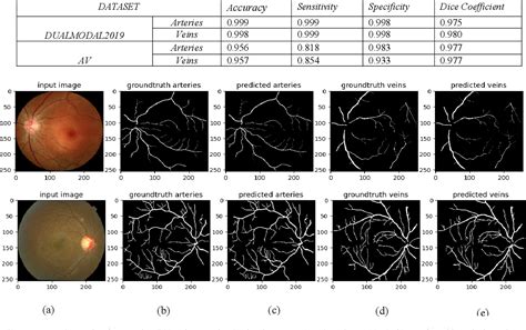 Figure 1 From Saf Net Split Attention Fusion Network For Retinal Vessel Segmentation From