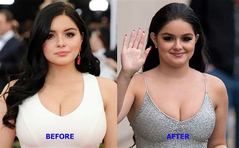 Chirurgies Plastiques Ariel Winter