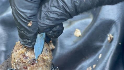 Jigger Removal Worst 2021 At Patricia Ho Blog