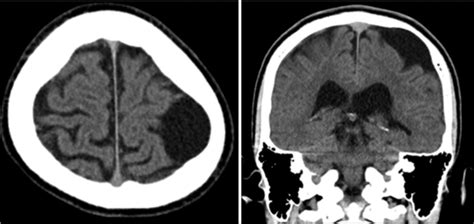Surgical Neurology International
