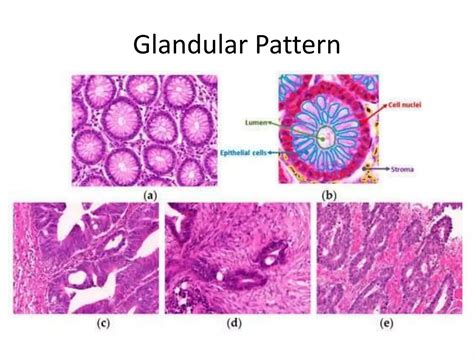 Histological Pattern Pptx Is Histology Patterns Ppt