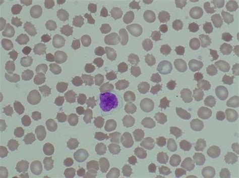 Helmet Cells Vs Bite Cells
