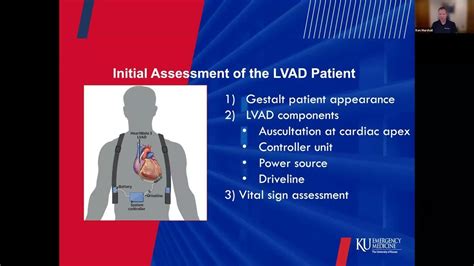 Lvad In The Emergency Department Youtube