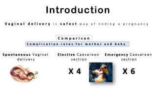 Conduct Of Vaginal Delivery PPTX