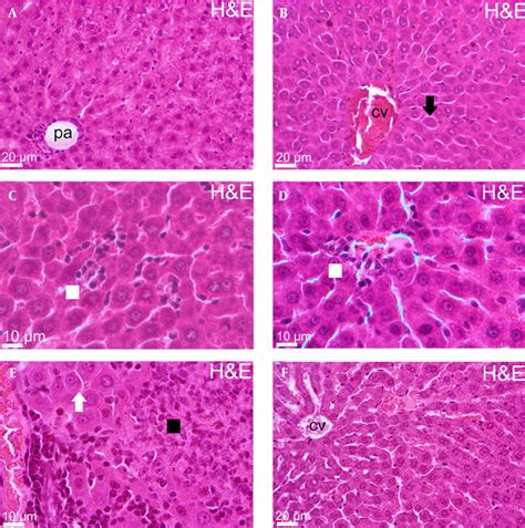 Liver Sections Stained With Hande Of All Experimental Groups Download