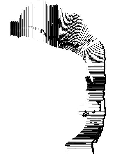 5 Segmented Ct Slices Developed From The Mumford Shah Algorithm In Download Scientific Diagram