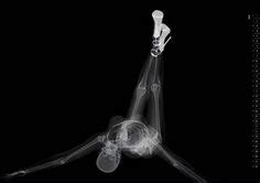 X Ray Art Ideas X Ray Xray Art Art