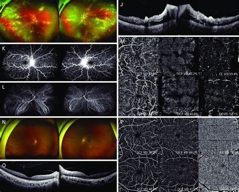 Continued I P Case Of The 25 Year Old Male Patient I M Initial Download Scientific