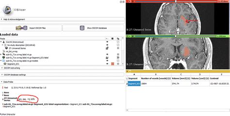 I Want To Obtain The X Y Coordinates Of The Regions I Have Segmented Support D Slicer