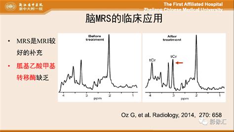 磁共振波谱分析（mrs 的主要代谢物及临床意义