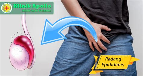 Analisa Radang Epididimis Dan Pemeriksaan Dokter Klinik Apollo Jakarta