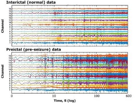 Using Machine Learning To Predict Epileptic Seizures From EEG Data MATLAB Simulink