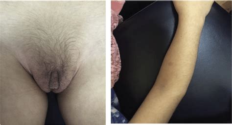 Follow Up After Months Download Scientific Diagram