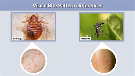 Bed Bug Bites Vs Mosquito Bites How To Tell The Difference