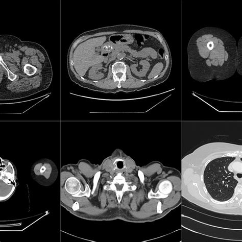 Pdf Low Dose Ct Via Convolutional Neural Network