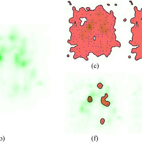A Shows The Workflow Of The Threshold Based Roi Algorithm B Shows