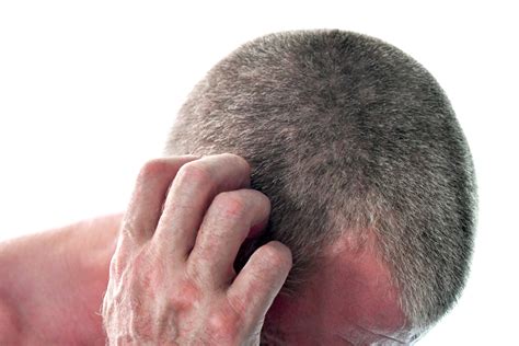 9 Possible Causes Of Scalp Bumps And When To Worry