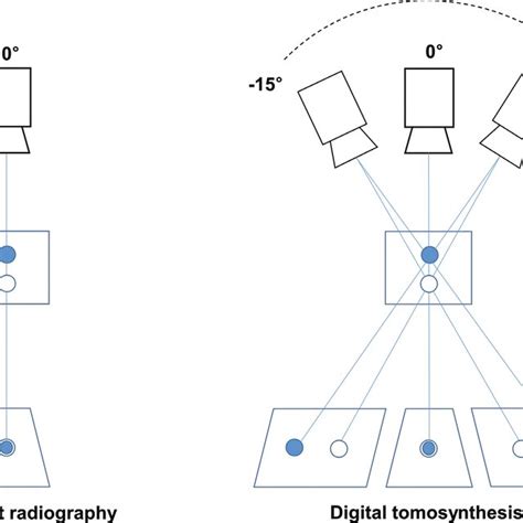 Figure S1 Principle Of Cxr And Dts Image Acquisition Download