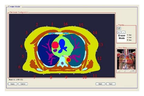 A Screen Shot Of The Developed Gui Electrodes Are Paired And Numbered