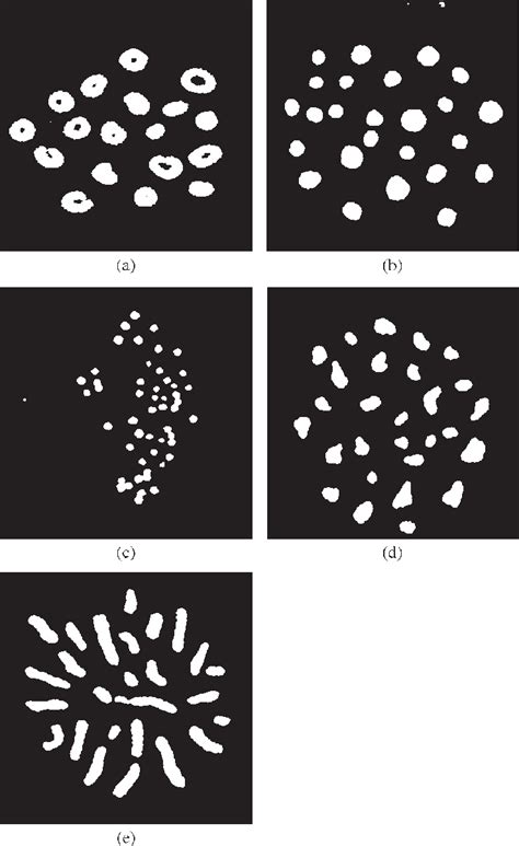 Some Typical Shapes Of Microcalcification Clusters Adapted From 55