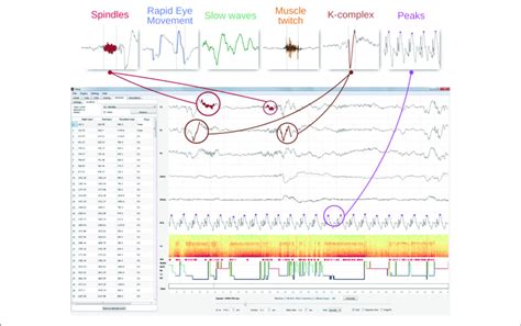 Gui Integration Of The Automatic Event Detection The Top Row