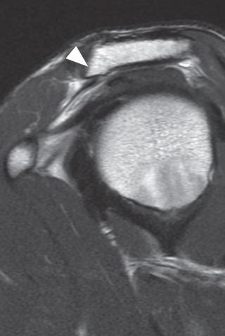 Glenohumeral Joint Imaging Clinical Tree