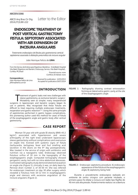 Pdf Endoscopic Treatment Of Post Vertical Gastrectomy Fistula