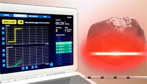 Cision Cls Rolf Ho Bornschein