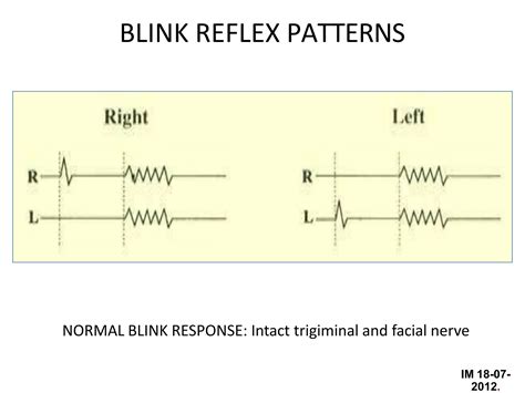 Blink Reflex Nerve Conduction Velocity Test Pptx