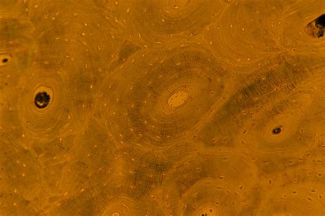 МИКРОСКОПИЧЕСКИЕ ФОТОГРАФИИ - СОЕДИНИТЕЛЬНАЯ ТКАНЬ - КОСТЬ